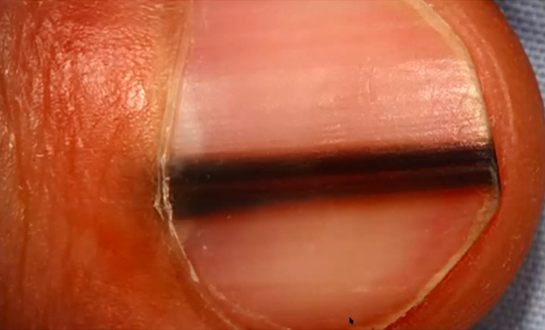 03(03): Saving a life – Nicholas Loh